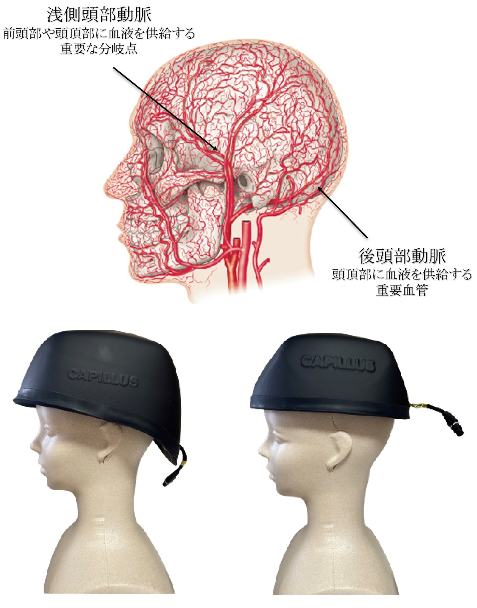 Capillus MD 320 プロフィッショナルモデル – Capillus Japan